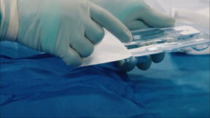 บริษัท Abbott เปิดตัวอุปกรณ์ติดตามภาวะหัวใจเต้นผิดจังหวะรุ่นใหม่ล่าสุด ...